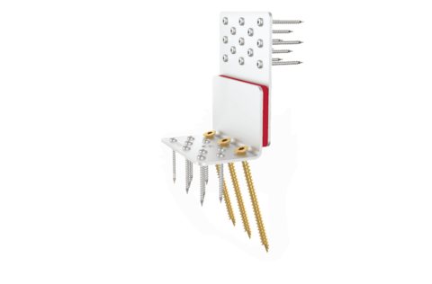 Sherpa Timber Connectors - Siegware - Architectural Innovations